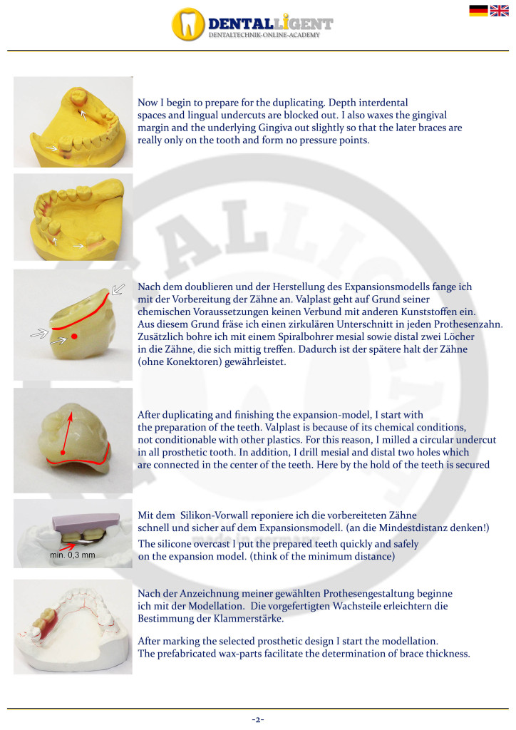 Werdegang einer Valplast-Prothese Teil 2 How to make a Valplast ...