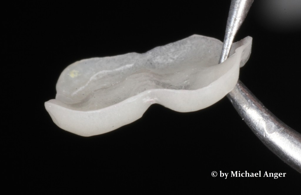 Table Tops & Composite | DENTALLIGENT | Blog