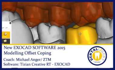 DENTALLIGENT | Modelling Offset Coping | E-Learning, Dental-CAD CAM Support