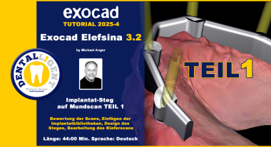 DENTALLIGENT | Exocad Elefsina 3.2 - 2025-4 - Implantat Steg auf Mundscan Teil 1 | E-Learning ...