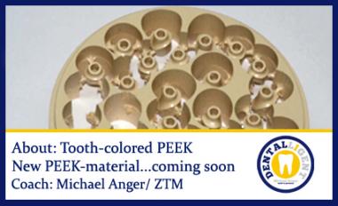 DENTALLIGENT | Free full video - About: New tooth-coulored PEEK - New ...