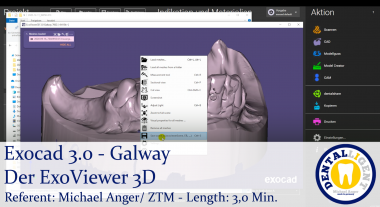 DENTALLIGENT | 2021-Exocad - Exocad 3.0 -Galway - Exoviewer 3D | E ...