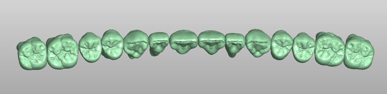 DENTALLIGENT | 28 root teeth individually in full anatomy as STL ...