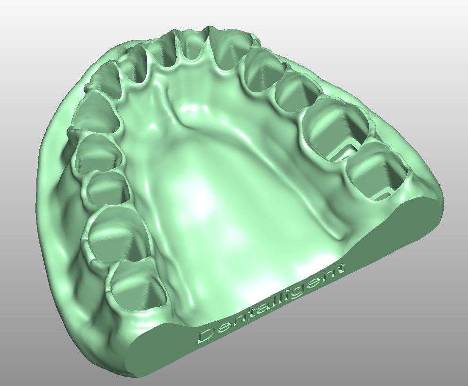 DENTALLIGENT | STL-FILES + LIBRARY - Upper jaw-MODELL with PIN- LIBRARY ...