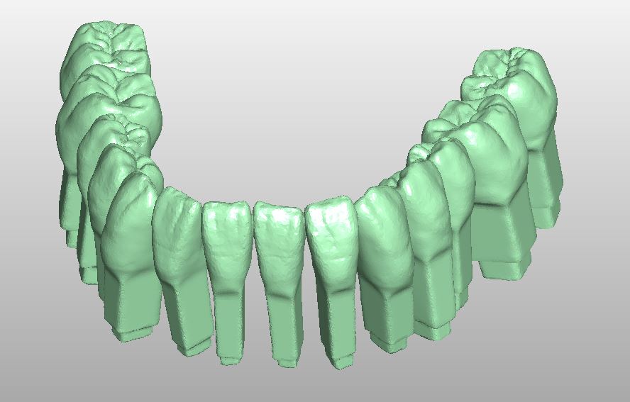 DENTALLIGENT | STL-FILES + LIBRARY - Upper jaw-MODELL with PIN- LIBRARY ...